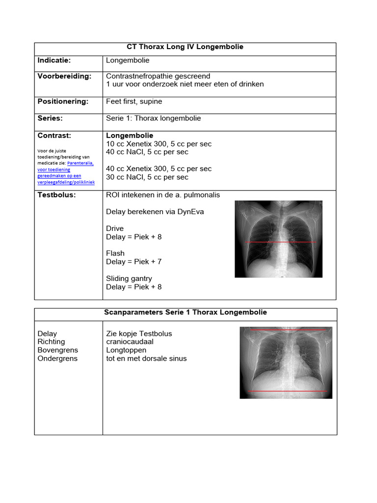 CT - Thorax Long IV Longembolie (Versie 3) | PDF