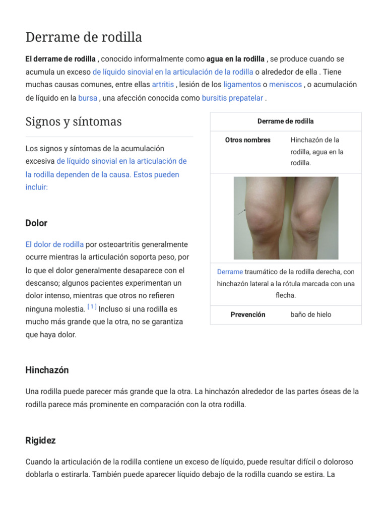 Derrame de rodilla - Wikipedia | PDF | Rodilla | Enfermedades y trastornos