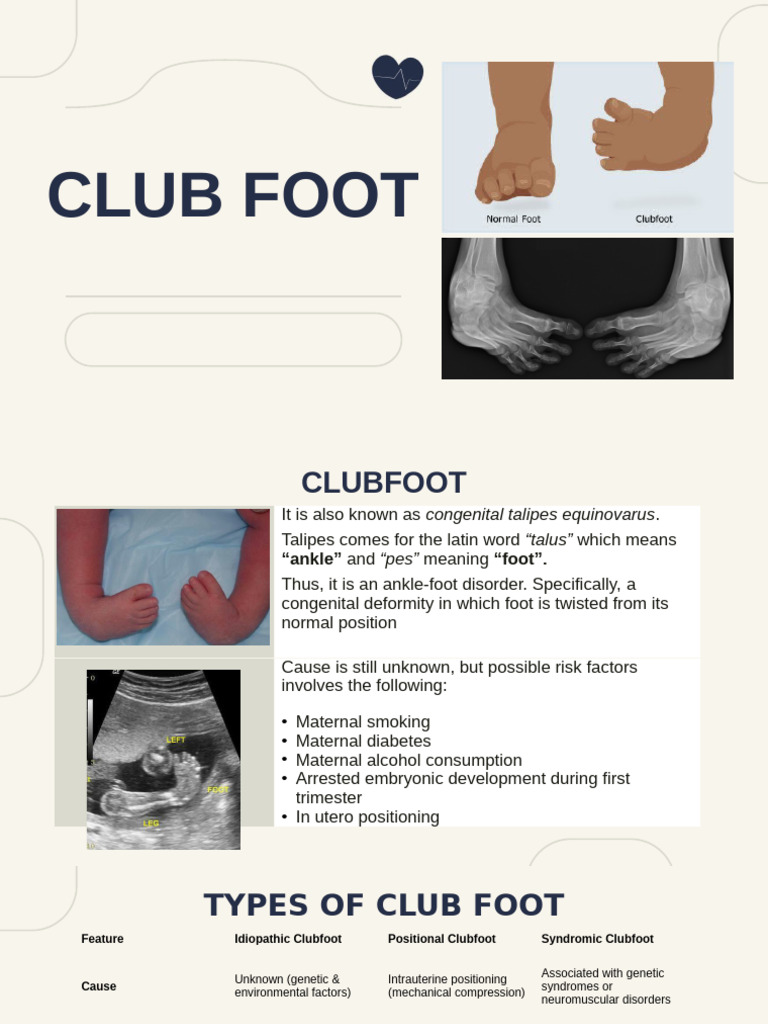 Clubfoot Presentation | PDF | Foot | Musculoskeletal System