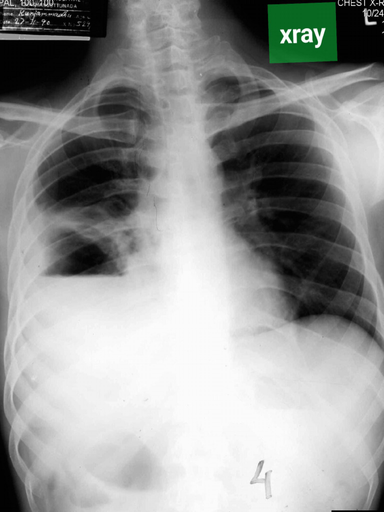 Surgery Xrays, Contrast, CTs | PDF