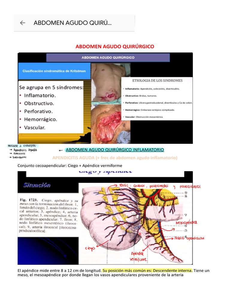 3ra Clase. Abdomen Agudo Qx | PDF | Medicina CLINICA | Especialidades Medicas