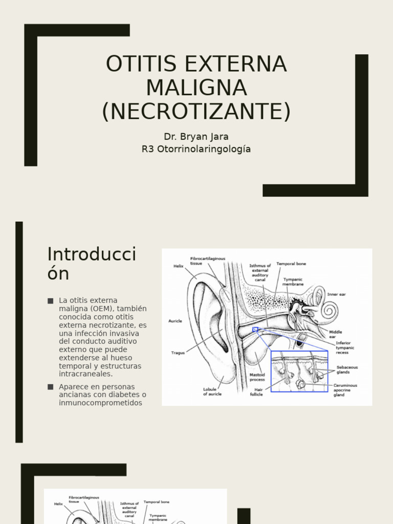 Otitis Externa Maligna: Diagnóstico y Tratamiento | PDF | Diabetes ...
