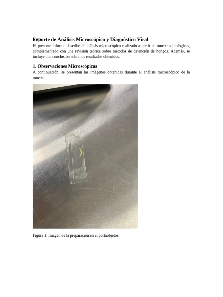 Reporte Analisis Microscopico y Diagnostico Viral | PDF | Virus | Interferón