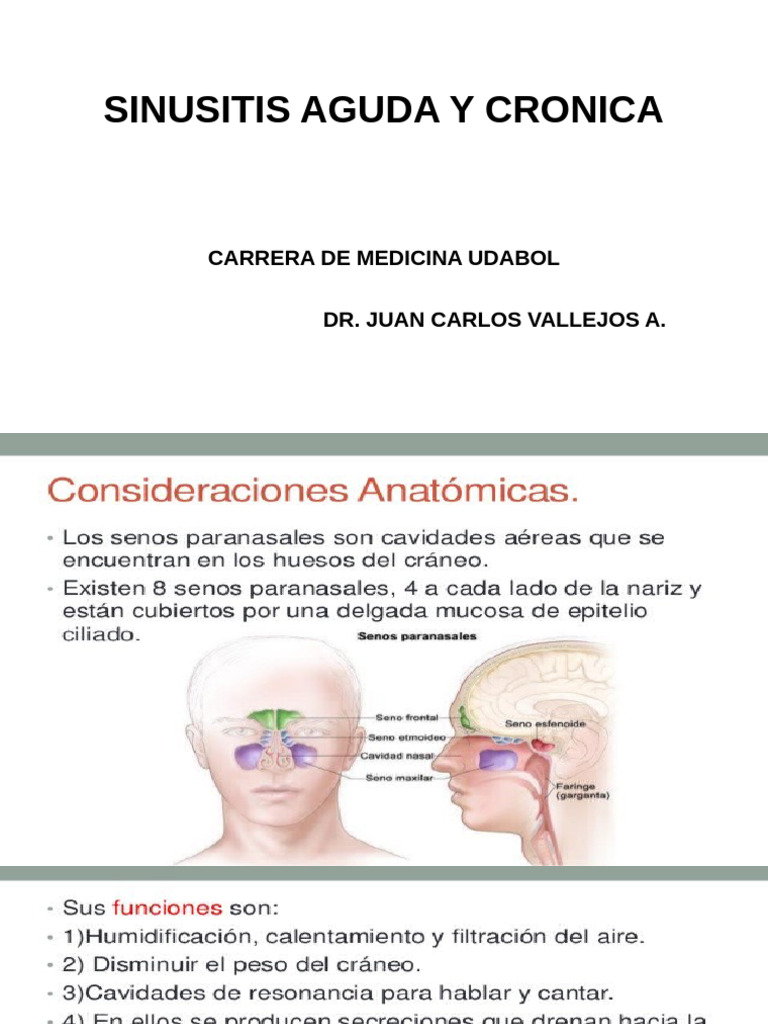 Sinusitis Aguda y Cronica | PDF