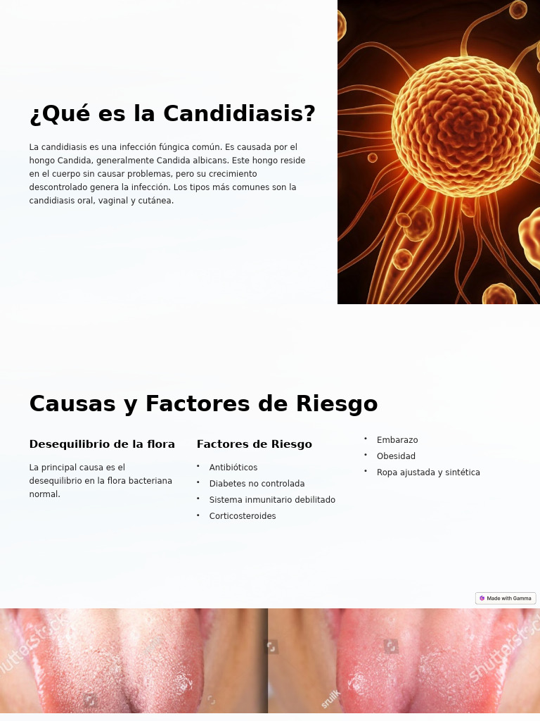 Que-es-la-Candidiasis | PDF | Candidiasis | Especialidades Medicas