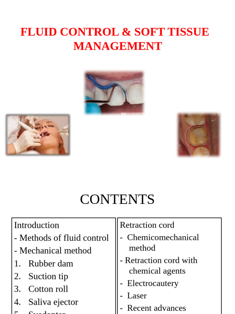 Fluid Control in Dental Procedures | PDF