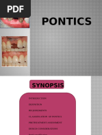 Pontics in Fixed Partial Denture | PDF | Dentures | Mouth