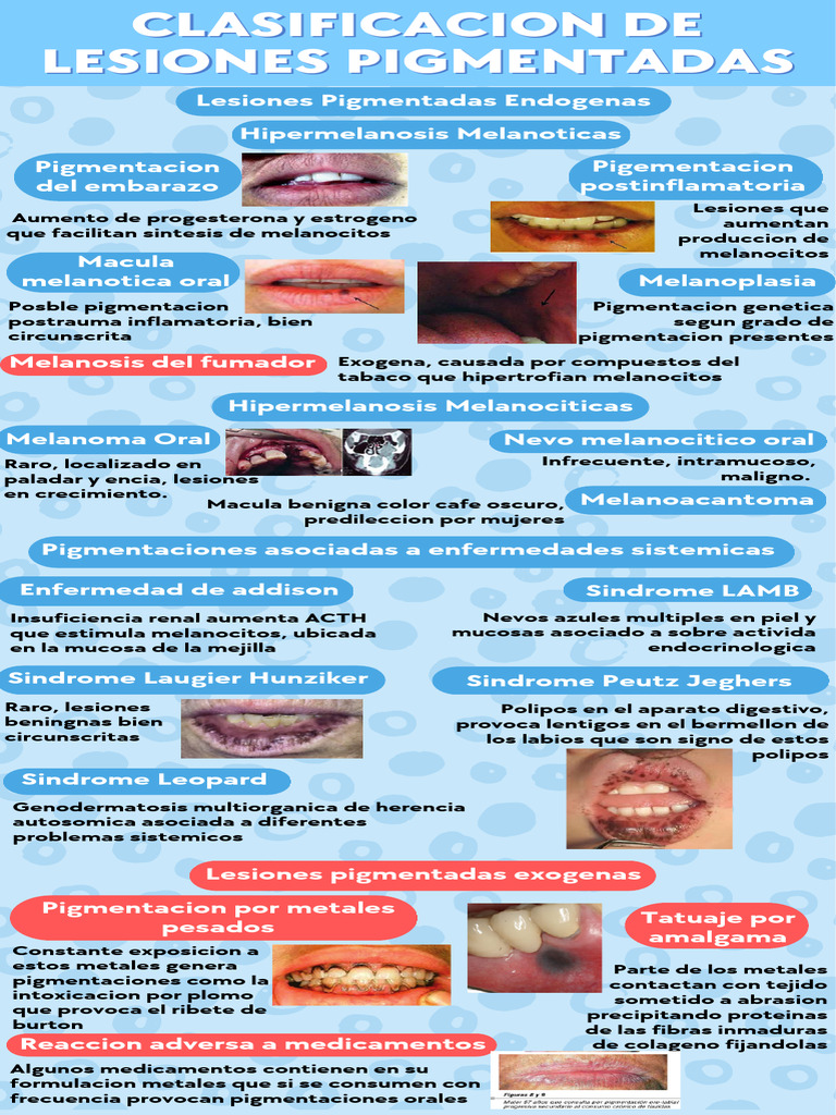 Infografia Lesiones Pigmentadas Enoc Gonzalez | PDF | Enfermedades y trastornos | Especialidades ...