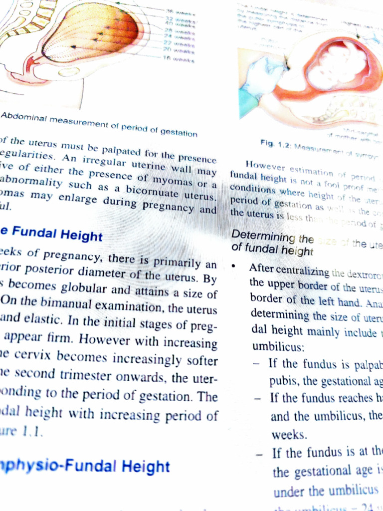 Fundal Height Measurement in Pregnancy | PDF | Uterus | Pregnancy