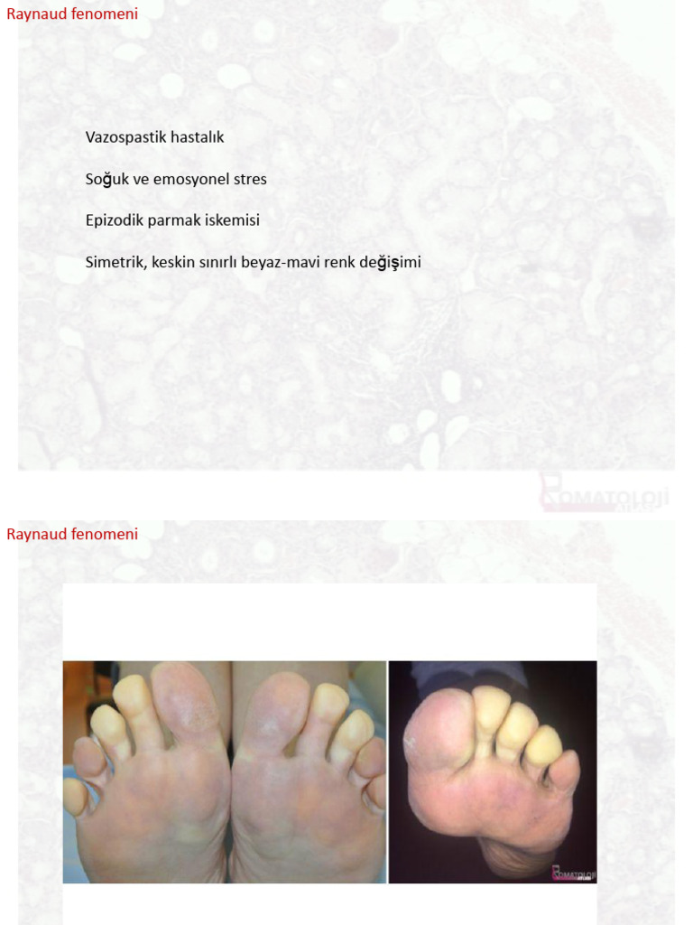 101-Diğer BDH | PDF