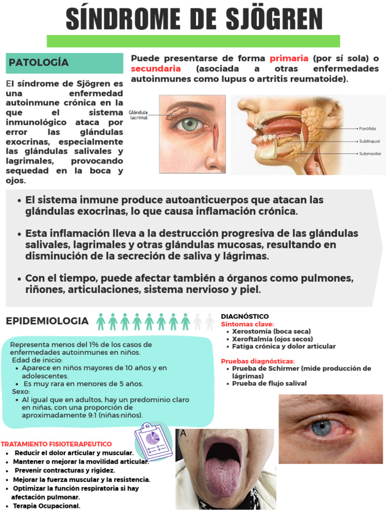 Sindrome de Sjogren | PDF