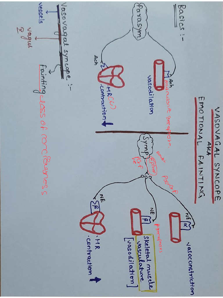 Vasovagal Syncope | PDF