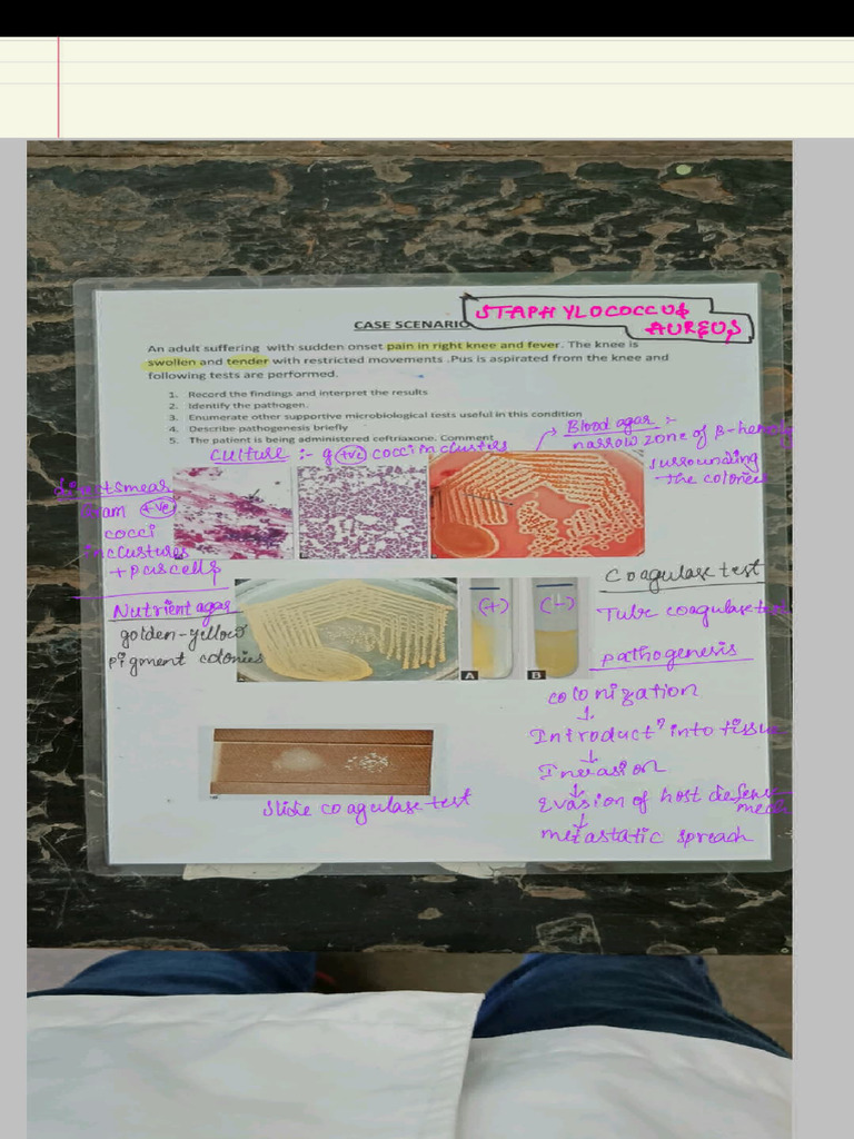 Micro Case Scenarios | PDF