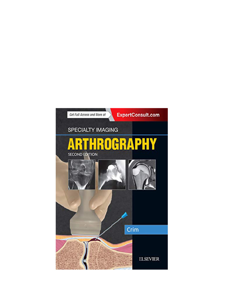 Specialty Imaging: Arthrography 2nd Edition Julia Crim Md - eBook PDF ...