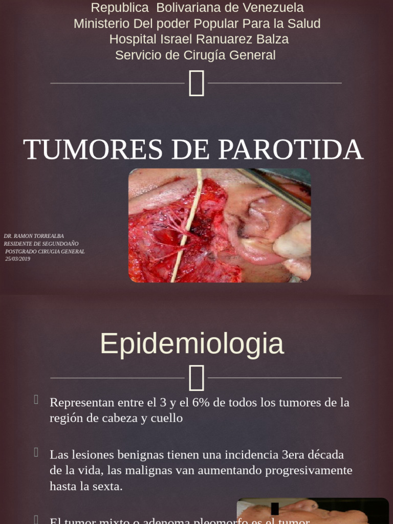 Tumores de Parótida: Epidemiología y Tratamiento | PDF | Cáncer ...