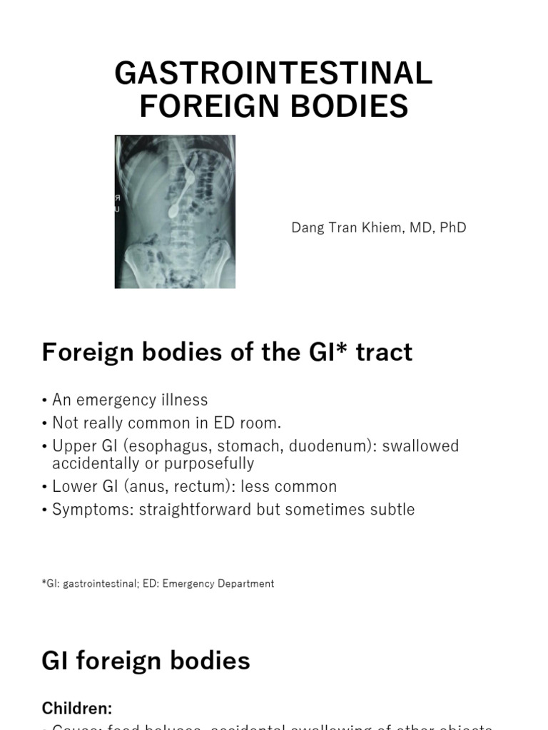 GI Foreign Bodies: Symptoms & Management | PDF