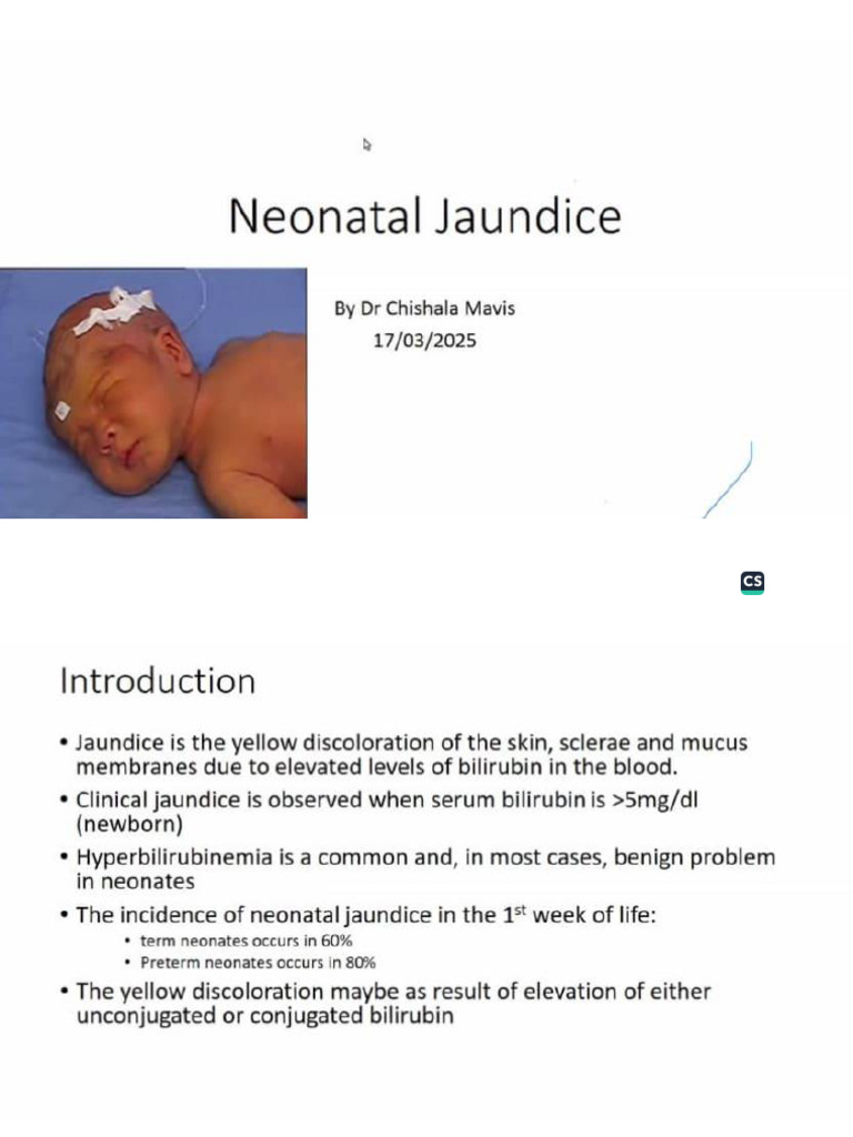 Neonatal Jaundice | PDF