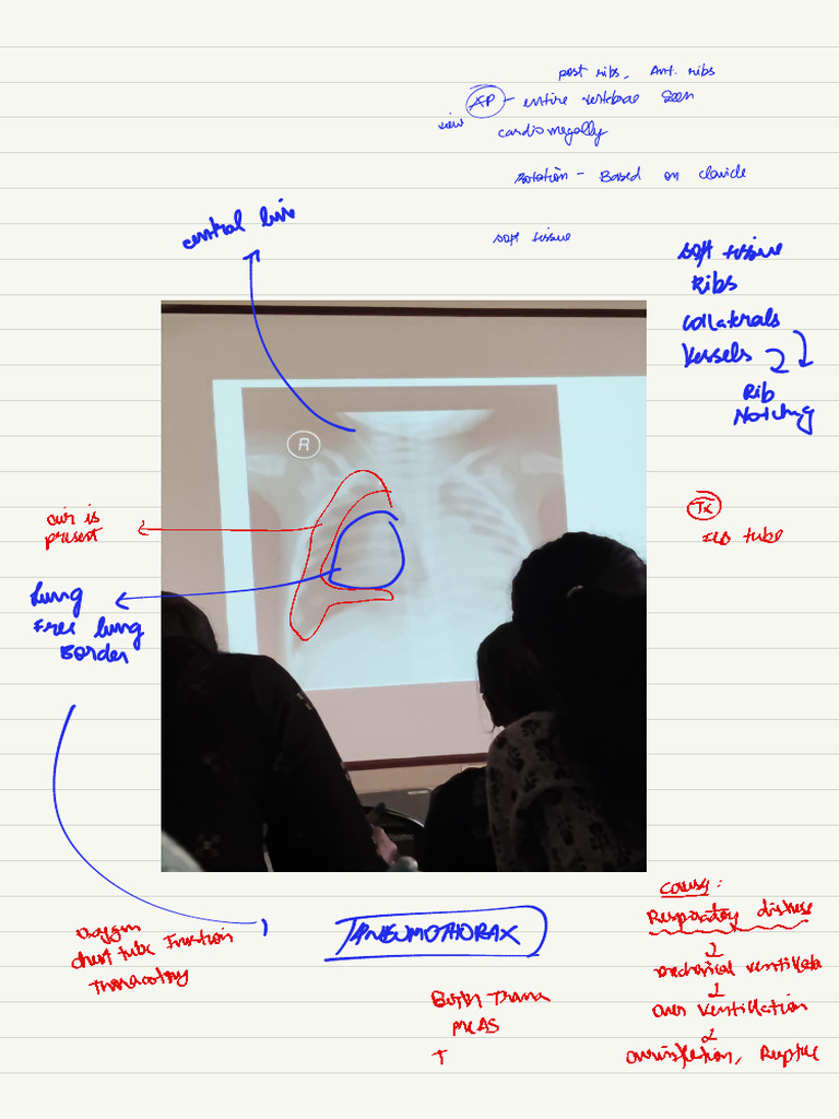 Paeds Xray KNK | PDF