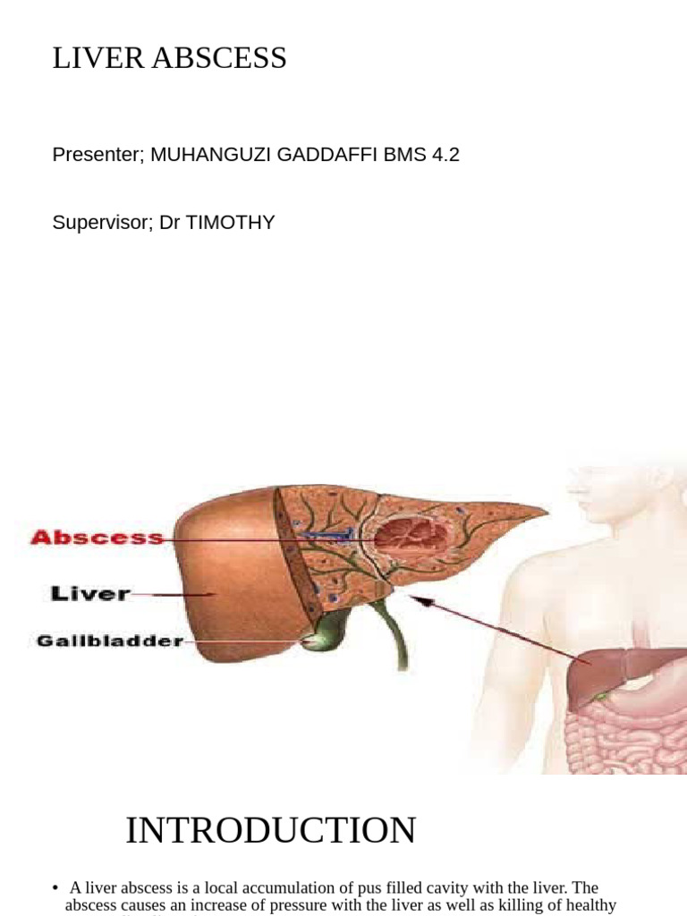 Liver Abscess: Causes and Management | PDF | Liver | Clinical Medicine