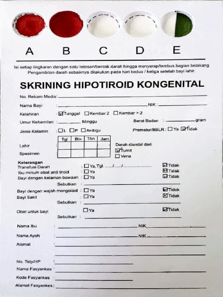 Scan Skrining Hipotiroid | PDF