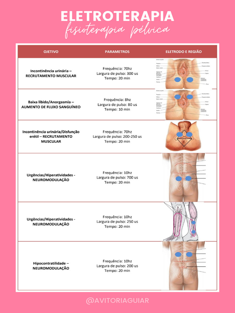 Eletro Pelvic - Onde Posicionar | PDF