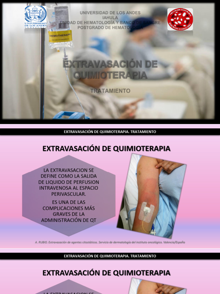 Extravasacion de Quimioterapia | PDF | Quimioterapia | Terapia intravenosa