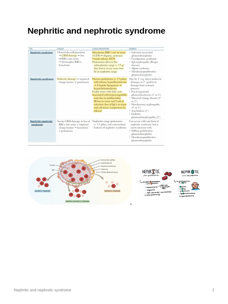X2 Nephritic - and - Nephrotic - Syndrome | PDF