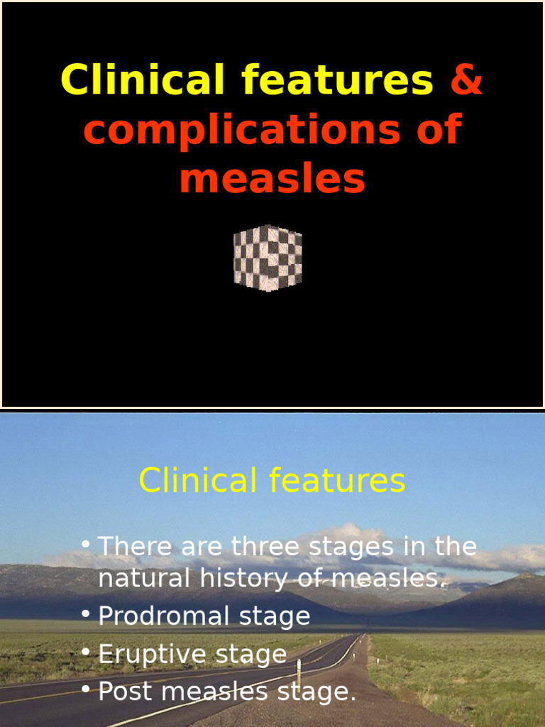 Measles: Stages and Complications | PDF | Measles | Pneumonia