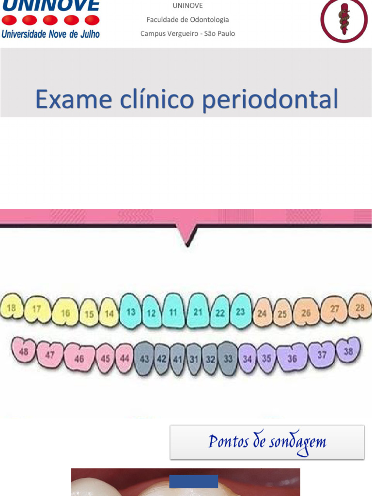 3 Lab Exame Periodontal Simplificado PSR | PDF