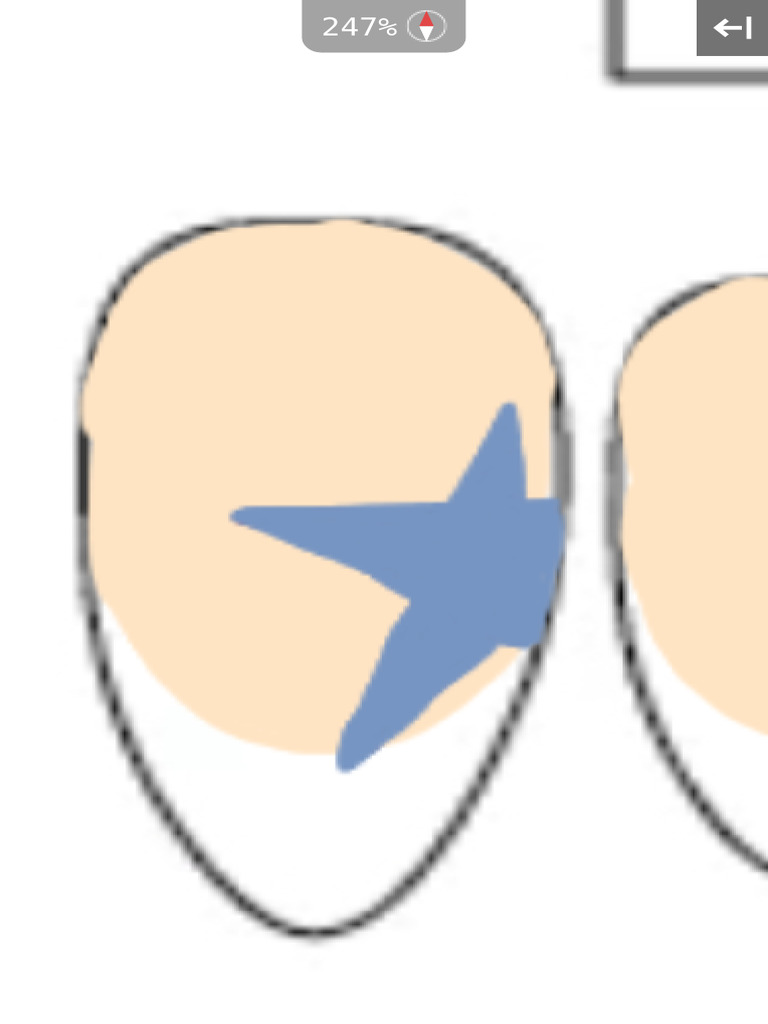 Unsaved - Kleki - Paint Tool | PDF