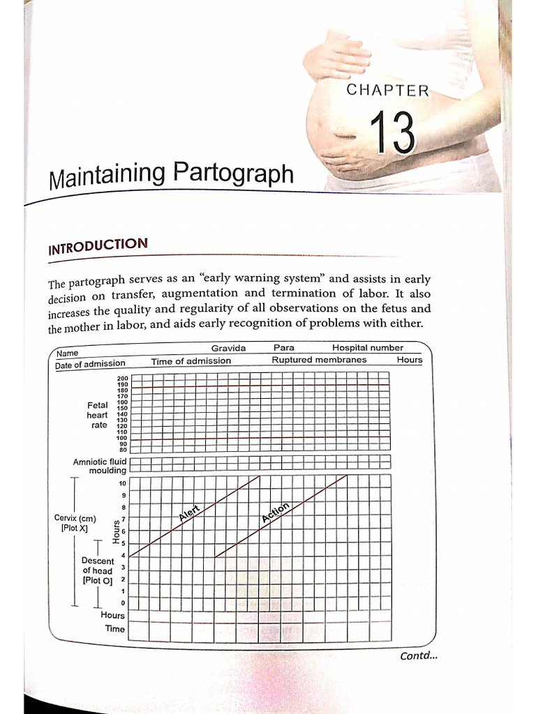 Partograph and Perineal Care | PDF