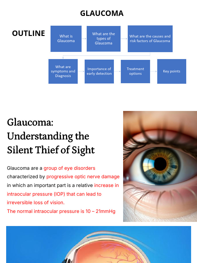 Glaucoma Prsentation 400l-2025 | PDF | Glaucoma | Diseases And Disorders
