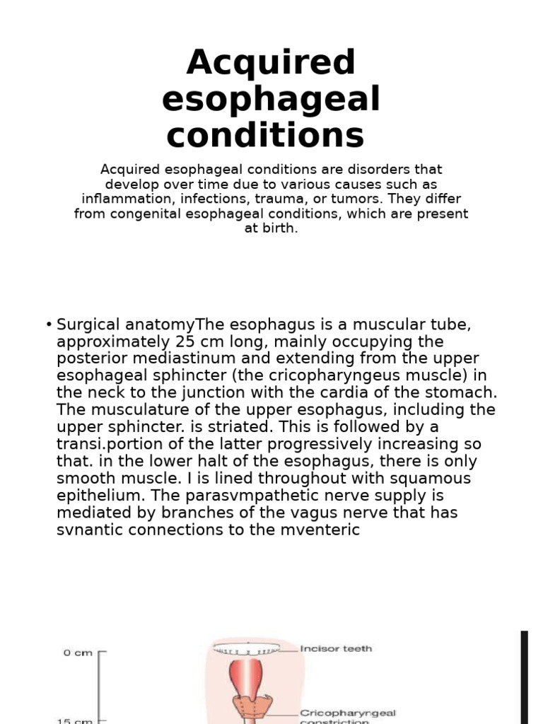 Acquired Esophageal Conditions Explained | PDF | Esophagus ...