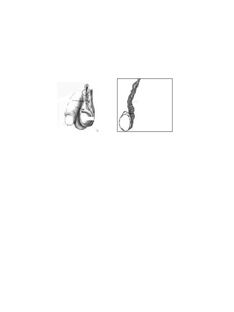 Varicocele Spanish | PDF | Testículo | Especialidades Medicas