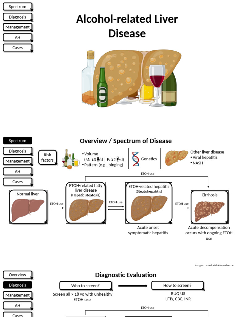Alcohol Liver Disease Yz 12.2 | PDF | Hepatitis | Cirrhosis