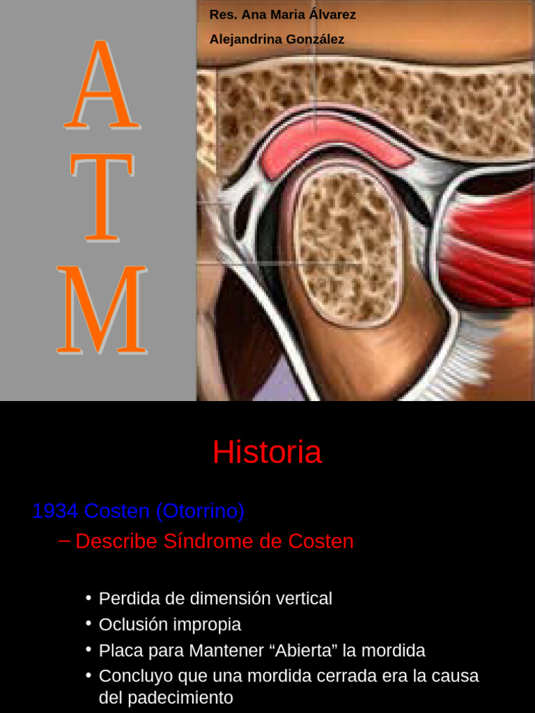 Historia y Tratamiento del Síndrome de Costen | PDF | Articulación ...