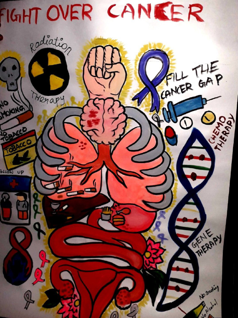 Cancer | PDF