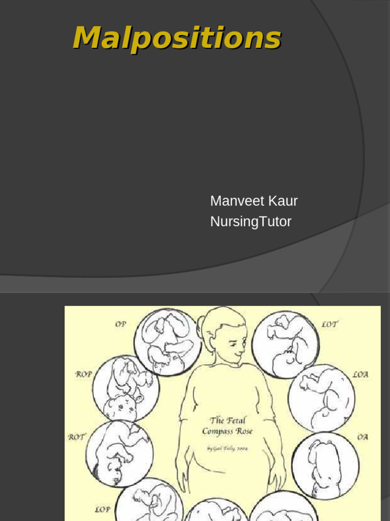 Types and Management of Malpositions | PDF | Childbirth | Pelvis