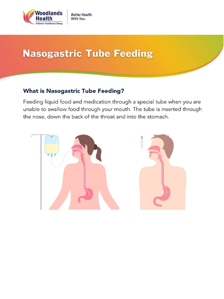 Nasogastric Tube Feeding | PDF