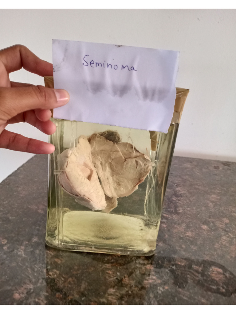 Pathology Specimen First | PDF