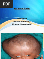 Sutural Diastasis in Hydrocephalus Case | PDF | Radiology | Medical ...