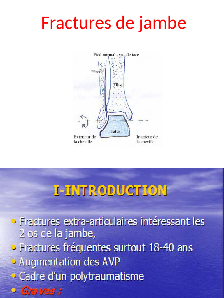 traumatismes de la jambe | PDF