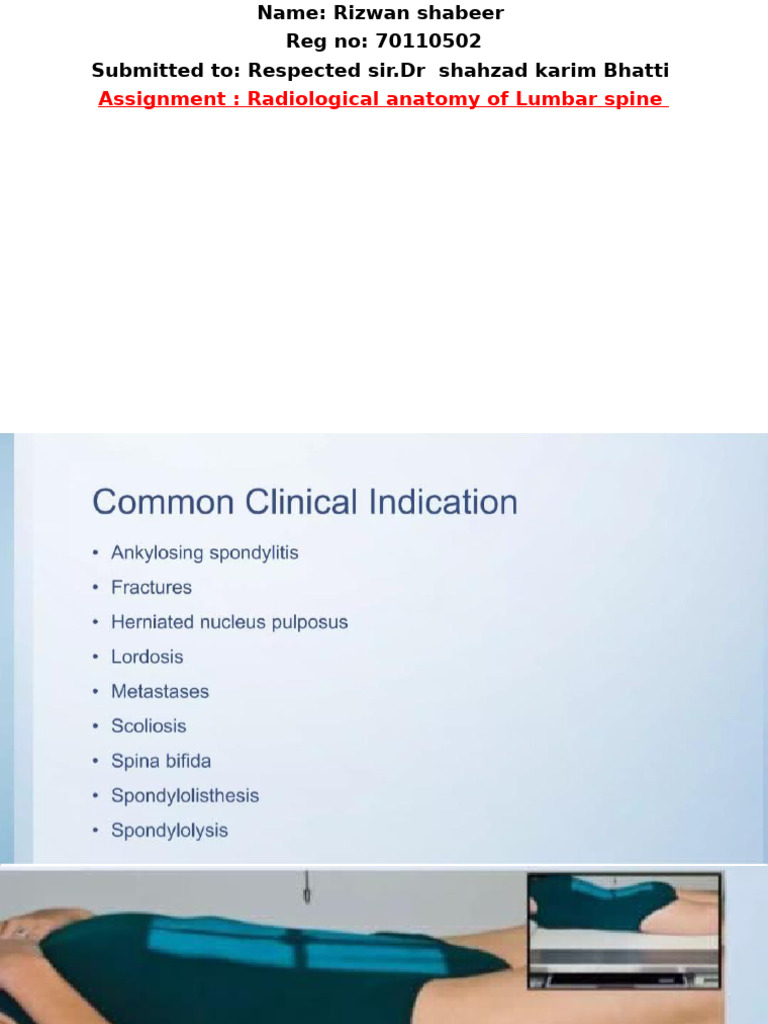 Rizwan Shabeer 70110502 | PDF