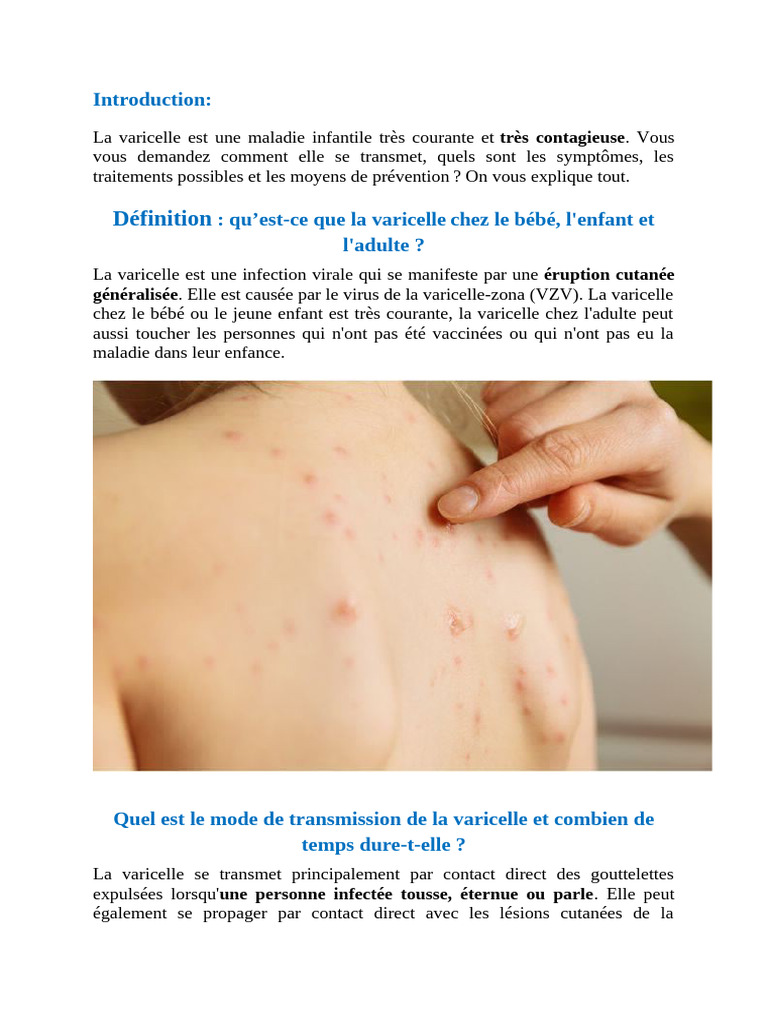 Comprendre la varicelle et le zona | PDF | Infection | Médecine