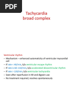 Ventricular Tachycardia - Monomorphic VT - LITFL | PDF ...