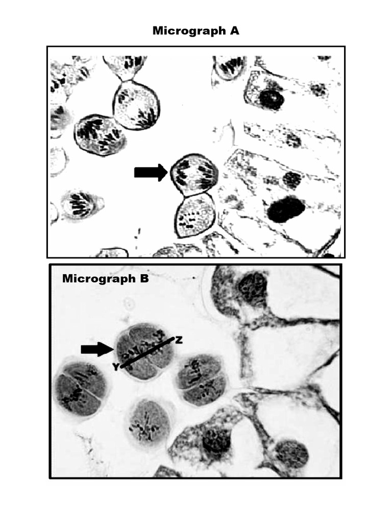 Meiosis Micrographs 2025 Prac | PDF
