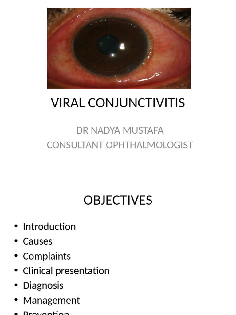 EKC Conjunctivitis: Overview and Management | PDF | Microbiology ...