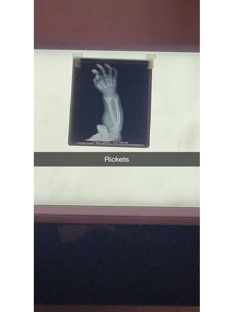 Pedia X Ray Exam Practical | PDF