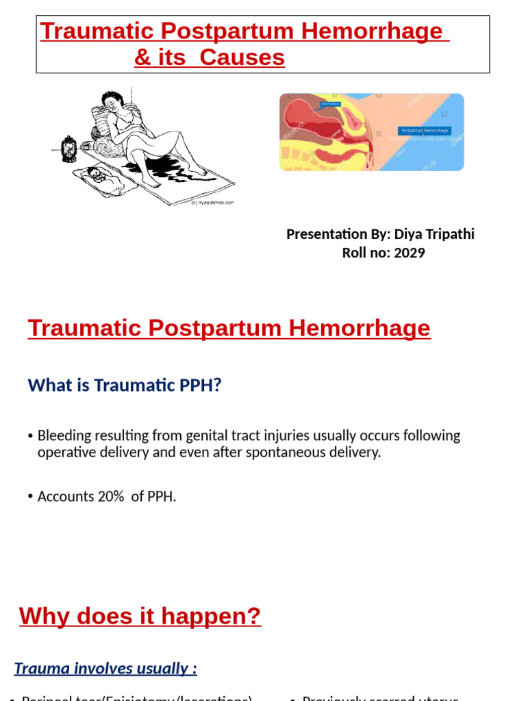 corrected Traumatic Postpartum Hemorrhage | PDF