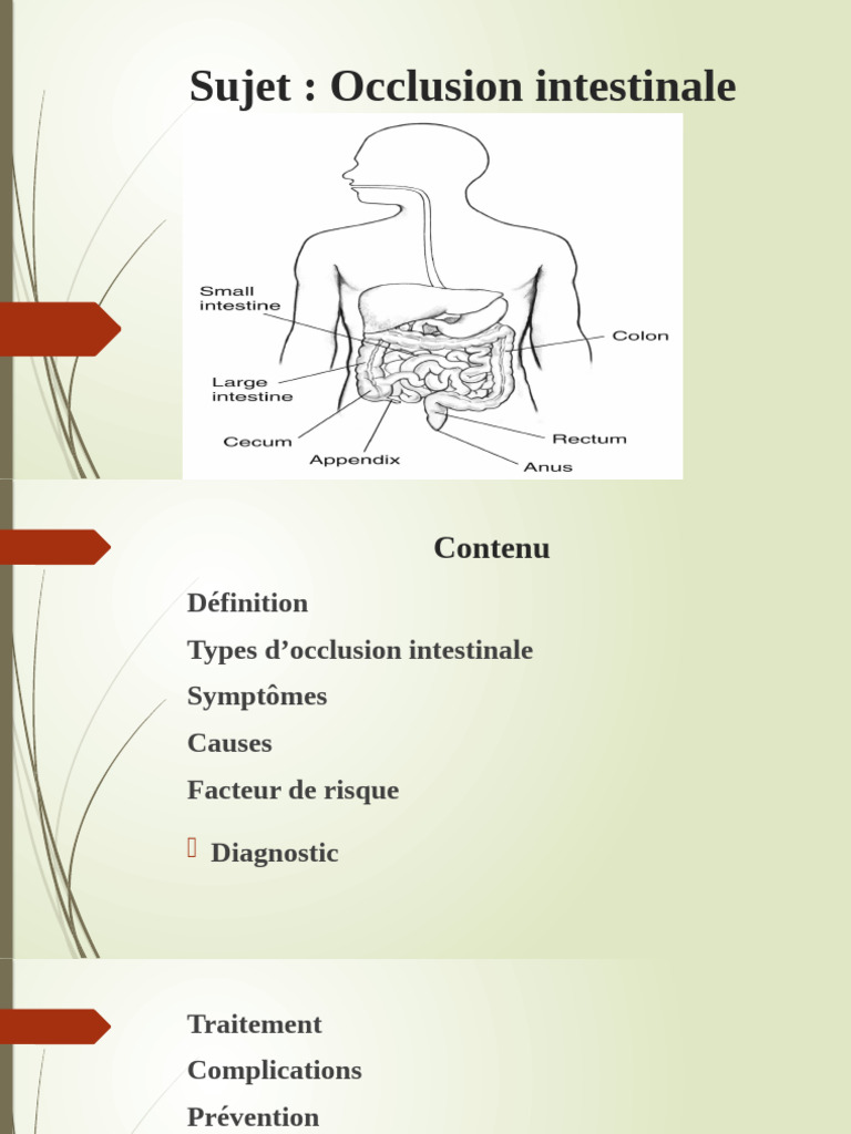 Traduction - Bowel Obstruction Le Sage | PDF | Tractus gastro ...